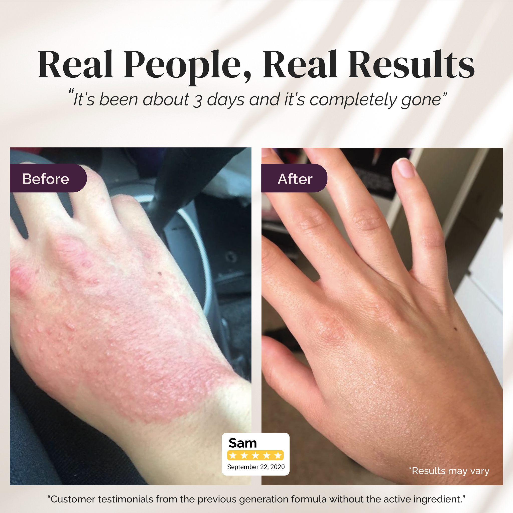 Eczema Cream – Puriya